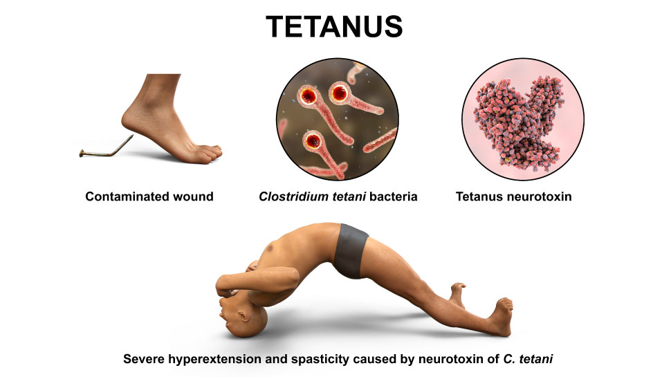 【細菌学クイズ3】細菌ってどうやって見分けるの？②芽胞形成と細胞内寄生について - Lab BRAINS